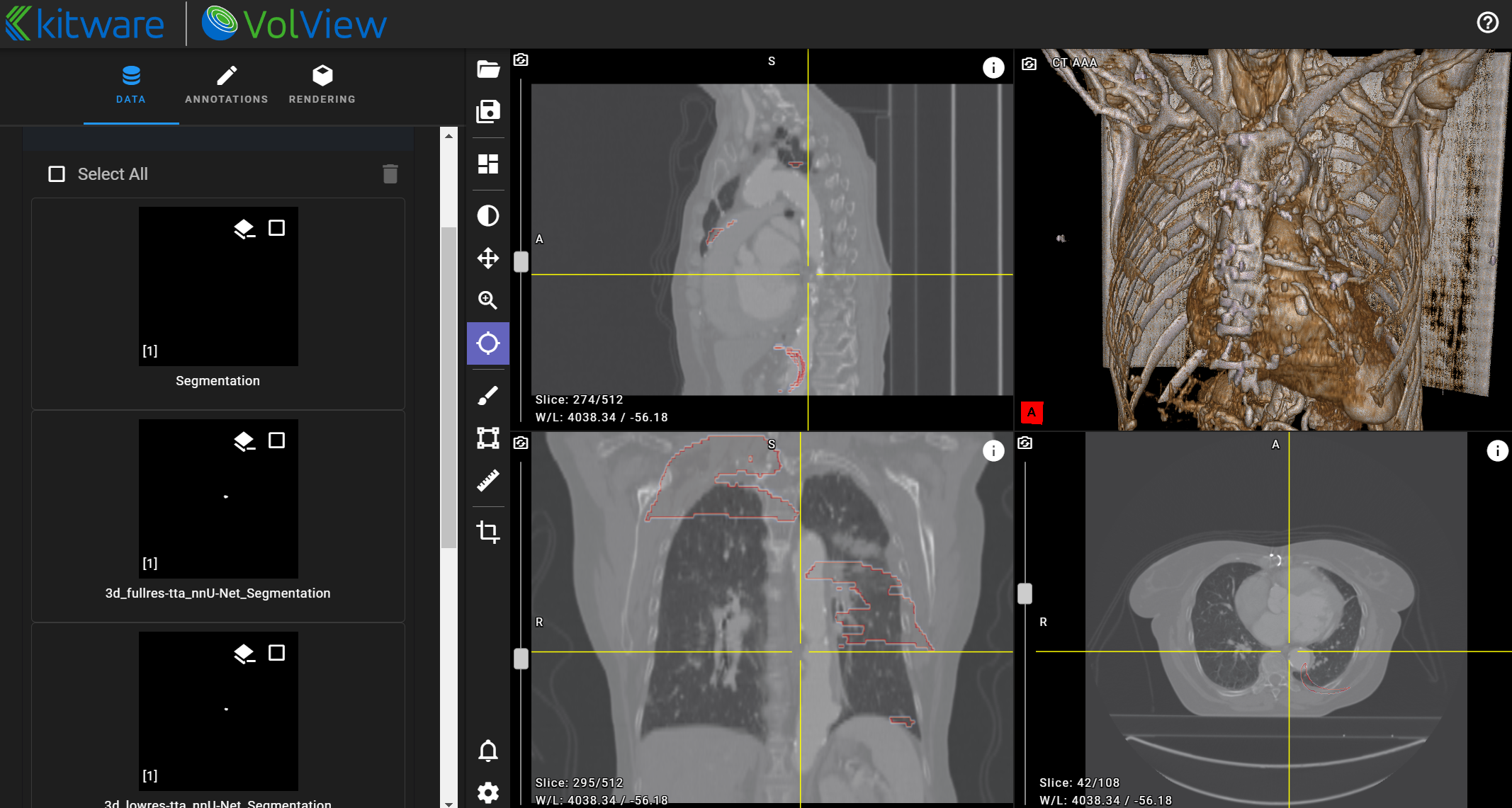 Unable to use VolView on macos Sonoma + Chrome · Issue #493 · Kitware/VolView · GitHub