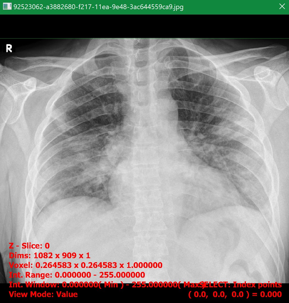 LoadImage Fails to Load Certain JPEGs · Issue #1007 · Project-MONAI ...