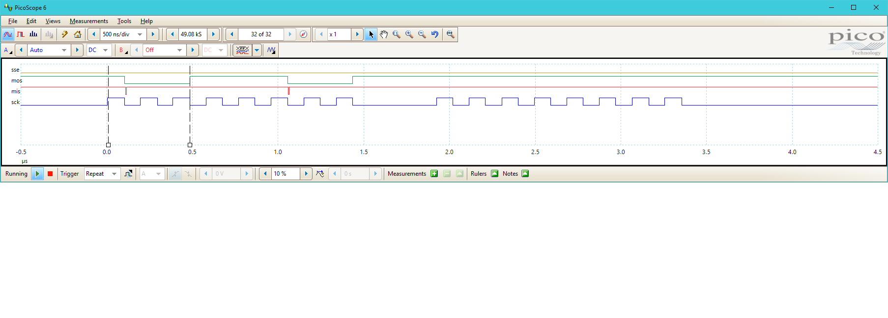 SPI read always returns 0xff on Ublox EVK ODIN W2 · Issue #4841 ...