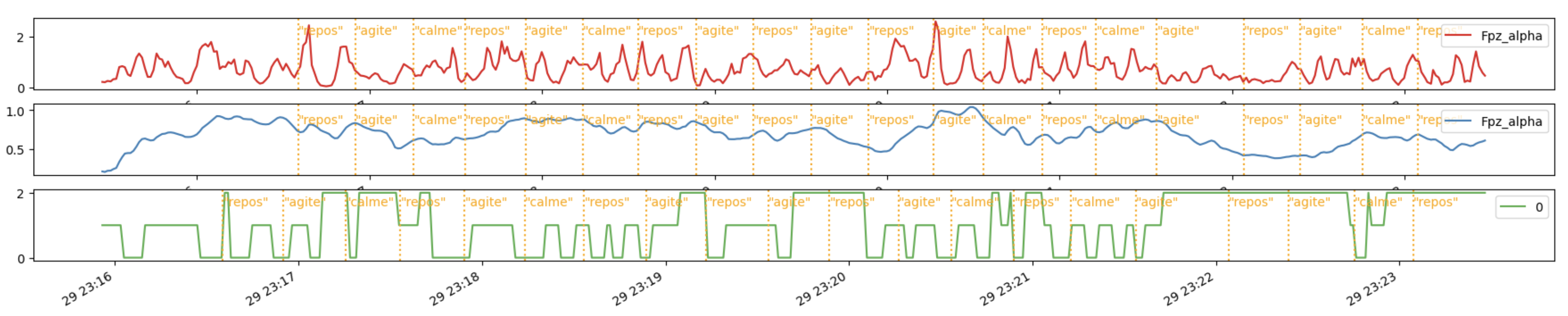 GitHub - owalid/ntx-hackathon-2022: [🧠 Neurotech] It's possible to measured the impact of music ...