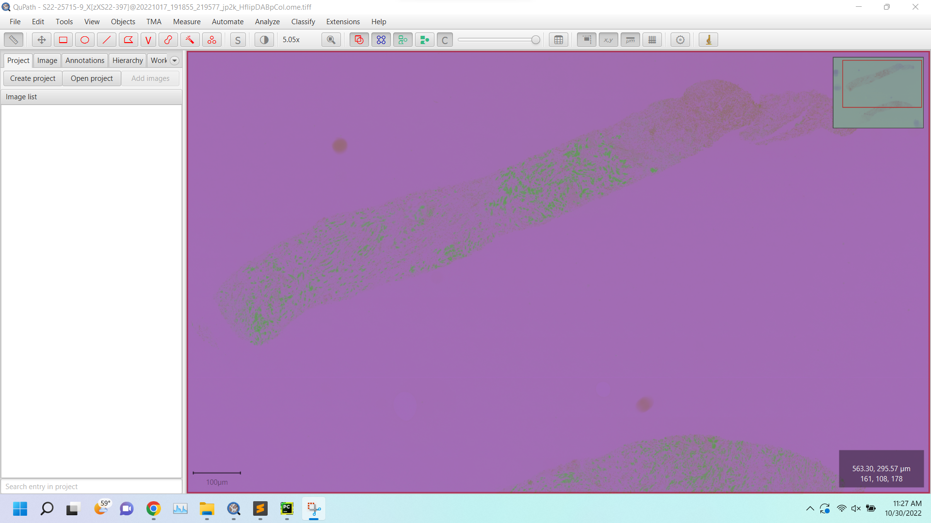 YCbCr colorspace from pyvips jp2k/jpeg compression causes brightfield/RGB ome.tiff image results ...