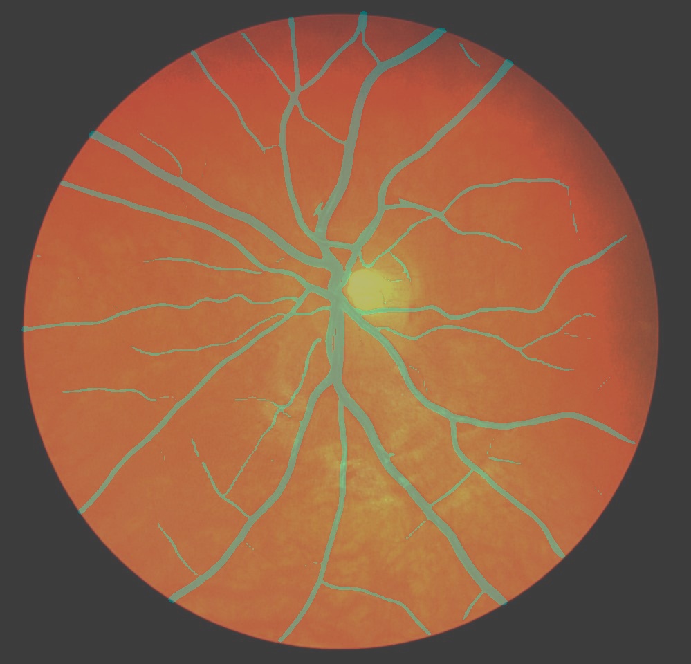 [Bug] Wrong output_tensorrt.jpg generated. · Issue #1979 · open-mmlab/mmdeploy · GitHub