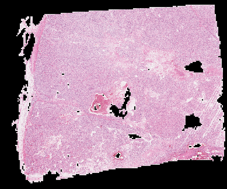 Loss of information in the resultant stitches · Issue #127 · mahmoodlab/CLAM · GitHub