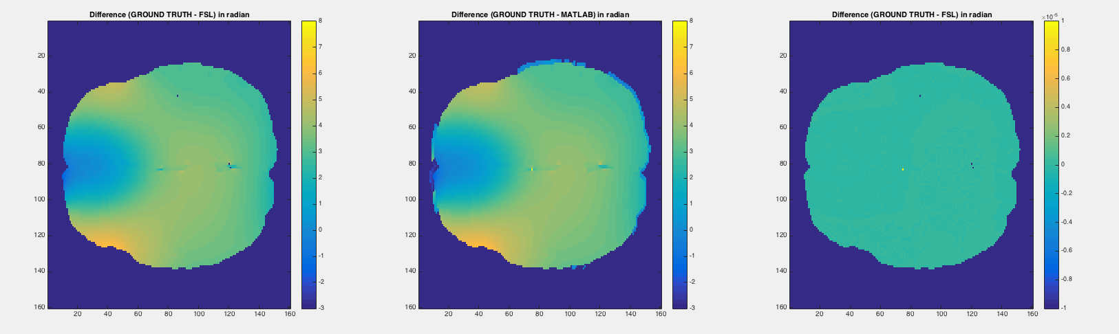 B0 mapping: Phase unwrapping · Issue #48 · qMRLab/qMRLab · GitHub
