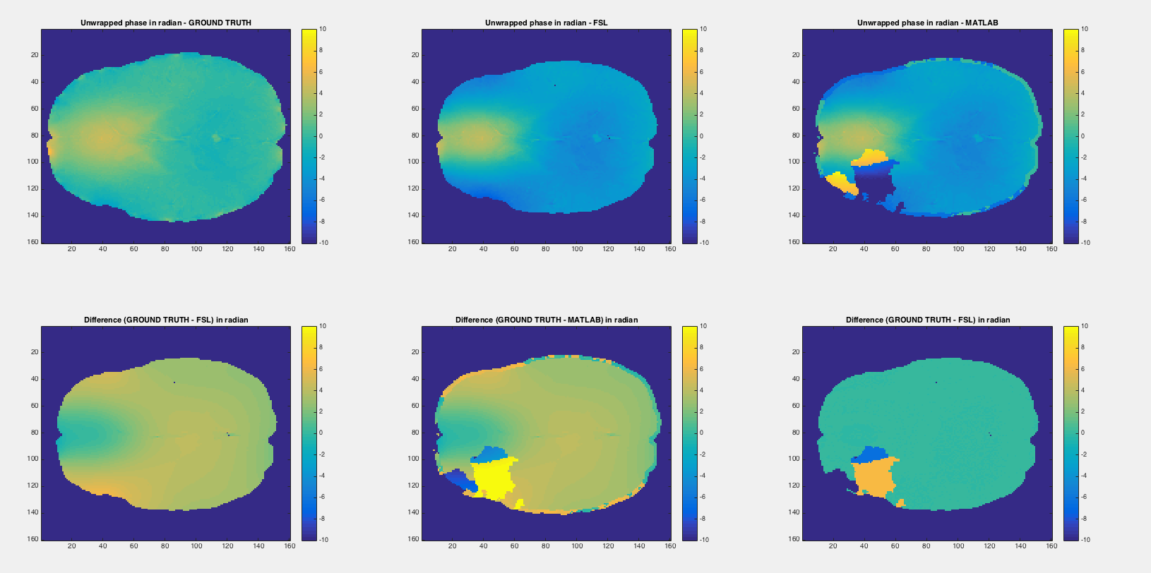 B0 mapping: Phase unwrapping · Issue #48 · qMRLab/qMRLab · GitHub