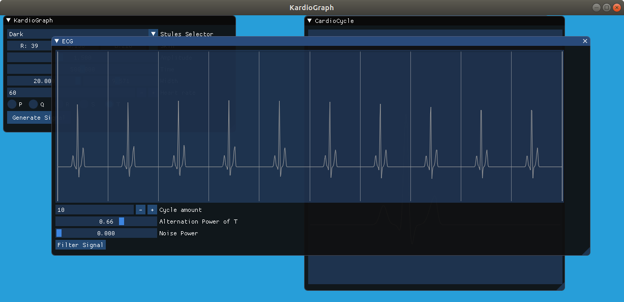GitHub - mrGoncharuk/kardiograph: GENERATIVE MODEL OF ARTIFICIAL ECG