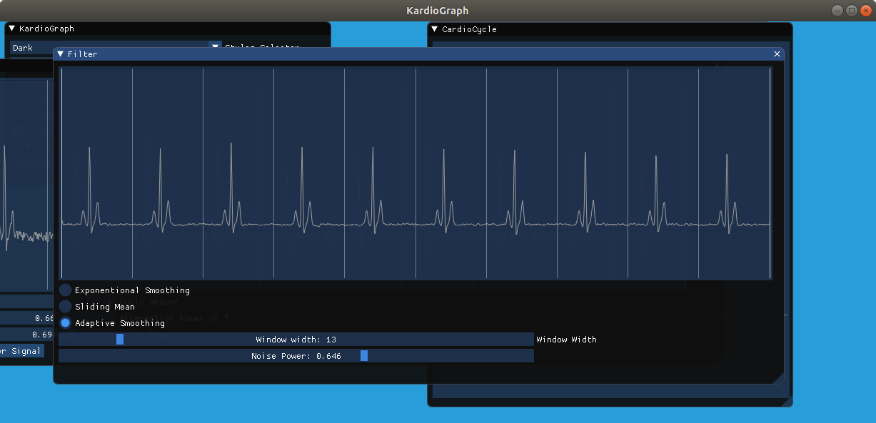 GitHub - mrGoncharuk/kardiograph: GENERATIVE MODEL OF ARTIFICIAL ECG