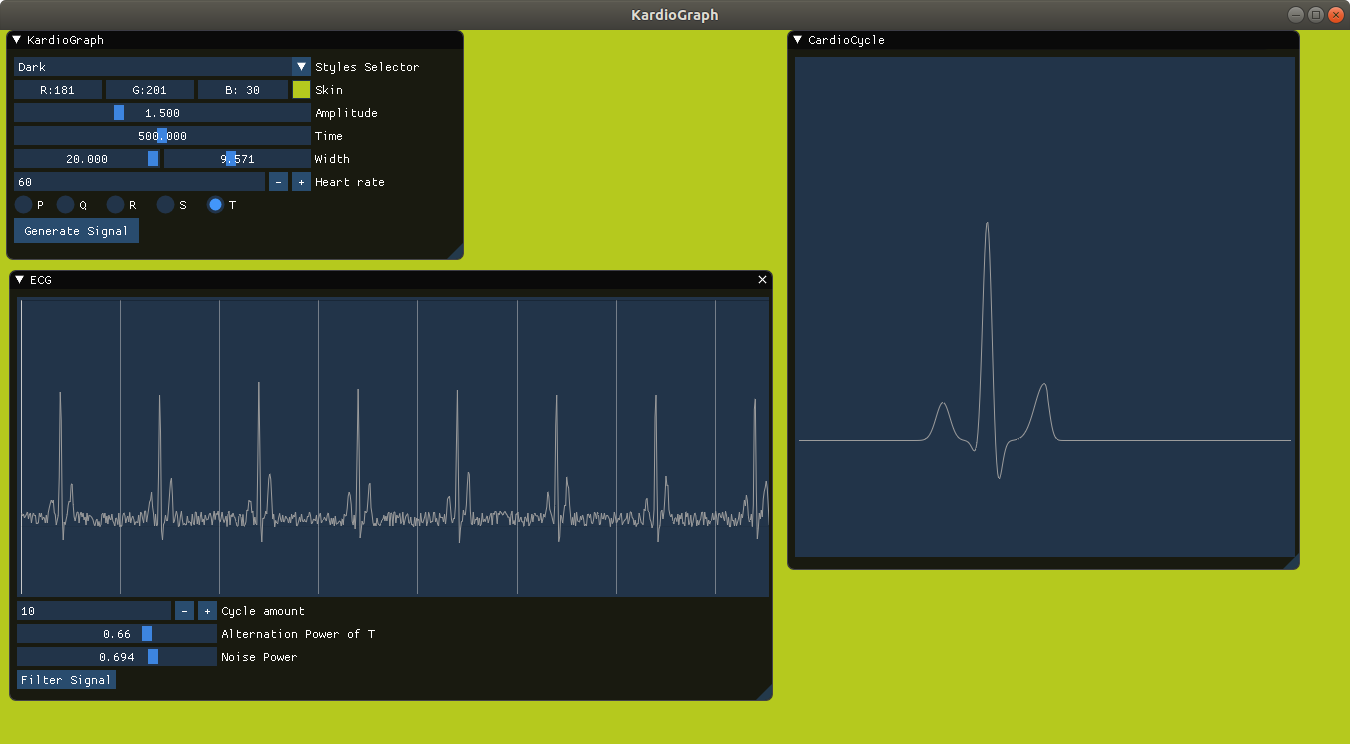 GitHub - mrGoncharuk/kardiograph: GENERATIVE MODEL OF ARTIFICIAL ECG