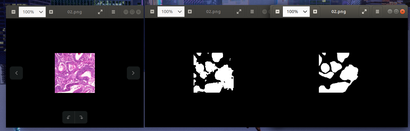 Loss Is Nan · Issue 3 · Jeya Maria Josemedical Transformer · Github