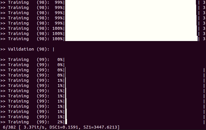 Data preprocess of Heart Dataset · Issue #4 · mathilde-b/SFDA · GitHub