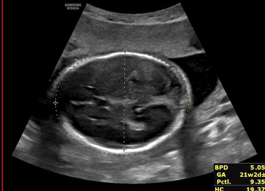 Bug Mask Rcnn Tensorrt C Api Opencv 裁剪后的图片 输入无结果，但是 Clone 后，再输入就有结果了。 · Issue 2000 · Open