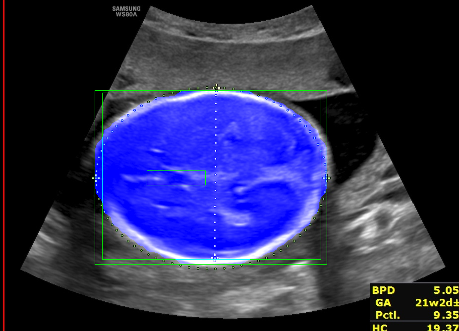 [Bug] mask rcnn tensorrt c++ API opencv 裁剪后的图片 输入无结果，但是 clone() 后，再输入就有结果了。 · Issue #2000 · open ...