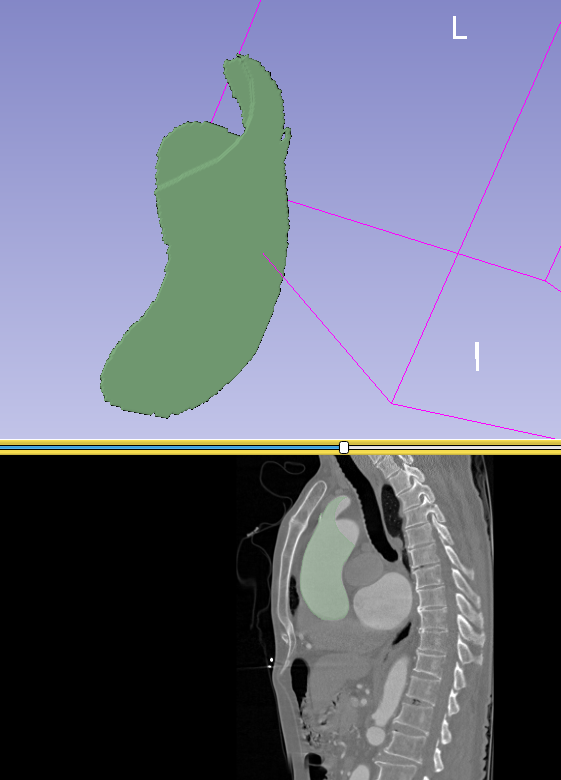 Isosurface Shows Unexpected Figure · Issue 761 · Marcomusyvedo · Github