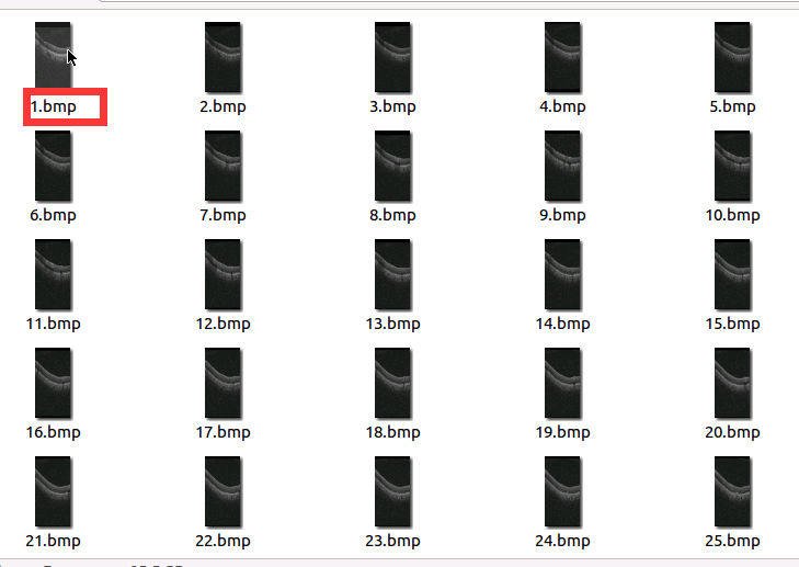 您好，关于您代码中，有一些问题想请教您 · Issue #1 · ShawnBIT/AI-Challenger-Retinal-Edema-Segmentation · GitHub