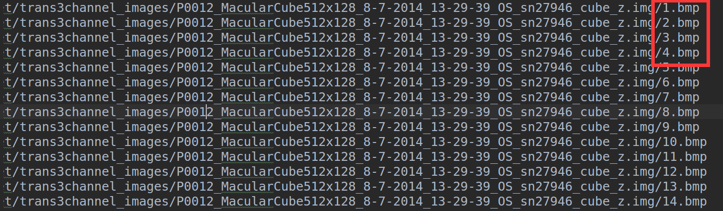 您好，关于您代码中，有一些问题想请教您 · Issue #1 · ShawnBIT/AI-Challenger-Retinal-Edema ...