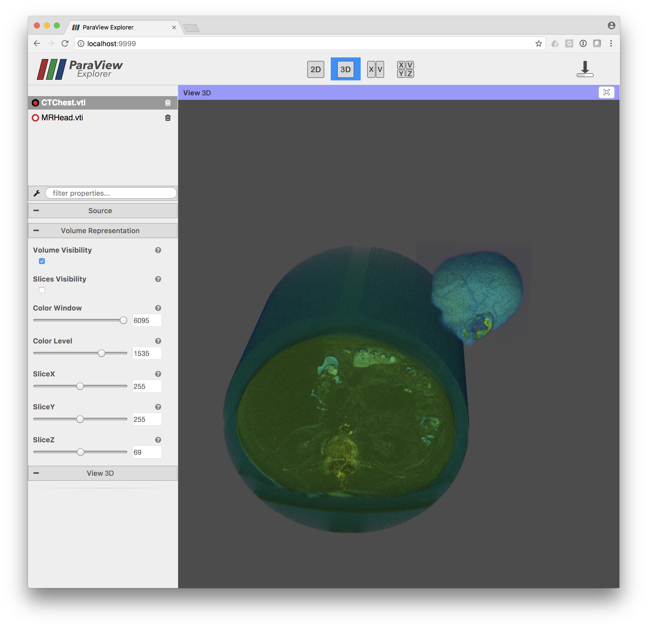 Rendering of multiple volumes are not intermixed or sorted correctly · Issue #473 · Kitware/vtk ...