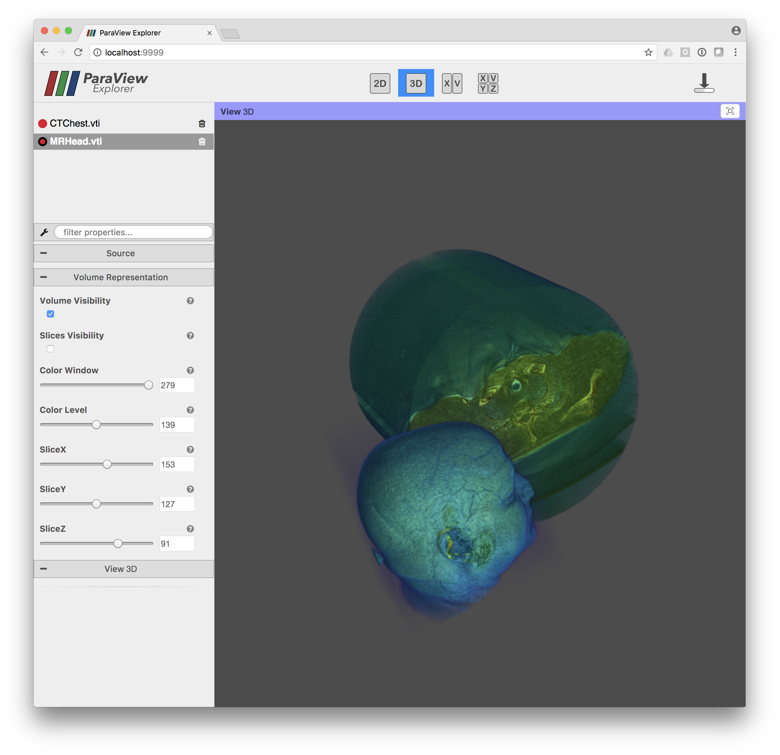 Rendering of multiple volumes are not intermixed or sorted correctly · Issue #473 · Kitware/vtk ...