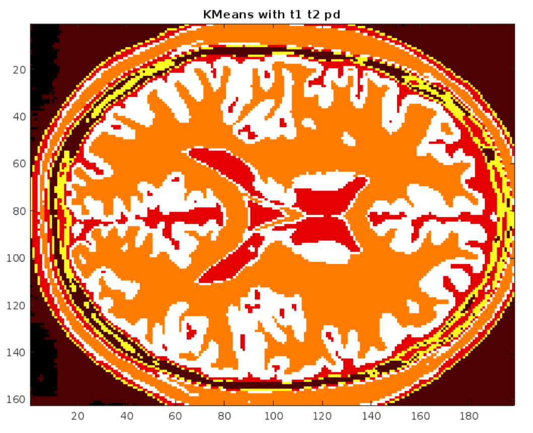 Github Mohamad Alikhanik Means Clustering Algorithm Used For Medical Images Segmentation K
