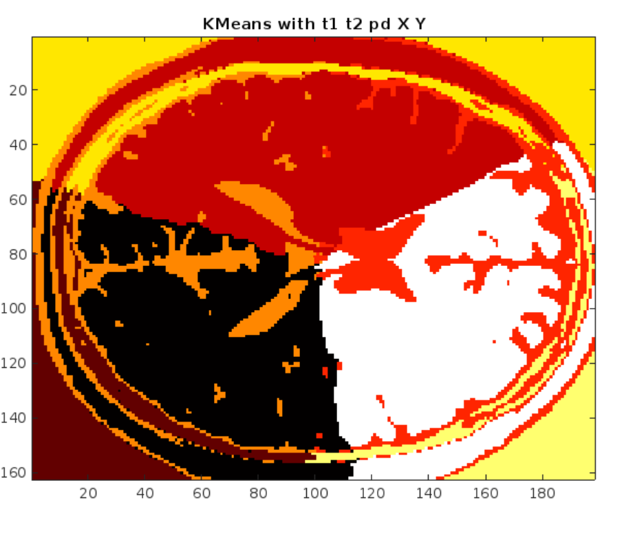 Github Mohamad Alikhani K Means Clustering Algorithm Used For Medical Images Segmentation K