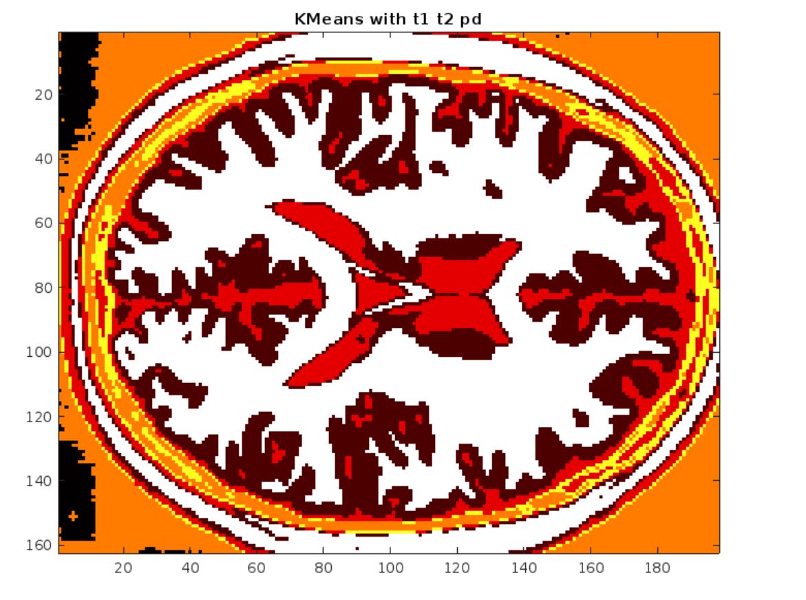 GitHub - Mohamad-Alikhani/K-means-clustering-algorithm-used-for-medical ...
