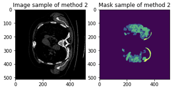 GitHub - beratuna/UNet-lesion-detection: In this project U-net ...
