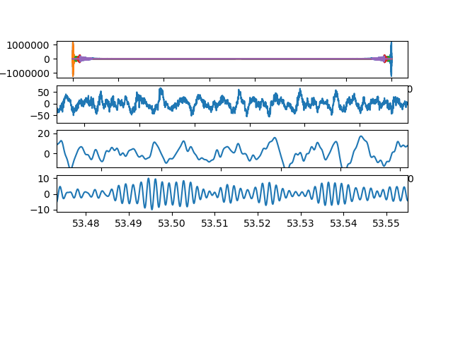 GitHub - zahransa/Time-Frequency-Analysis: This code is to present the signal and its ...