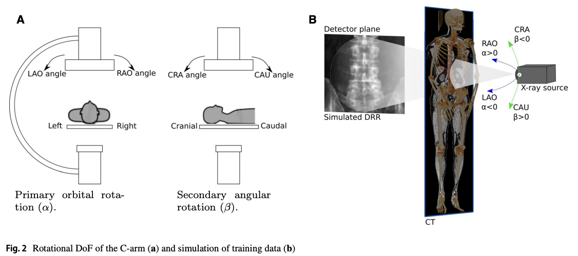 Change C-arm to move source and detector simultaneously · Issue #133 · eigenvivek/DiffDRR · GitHub