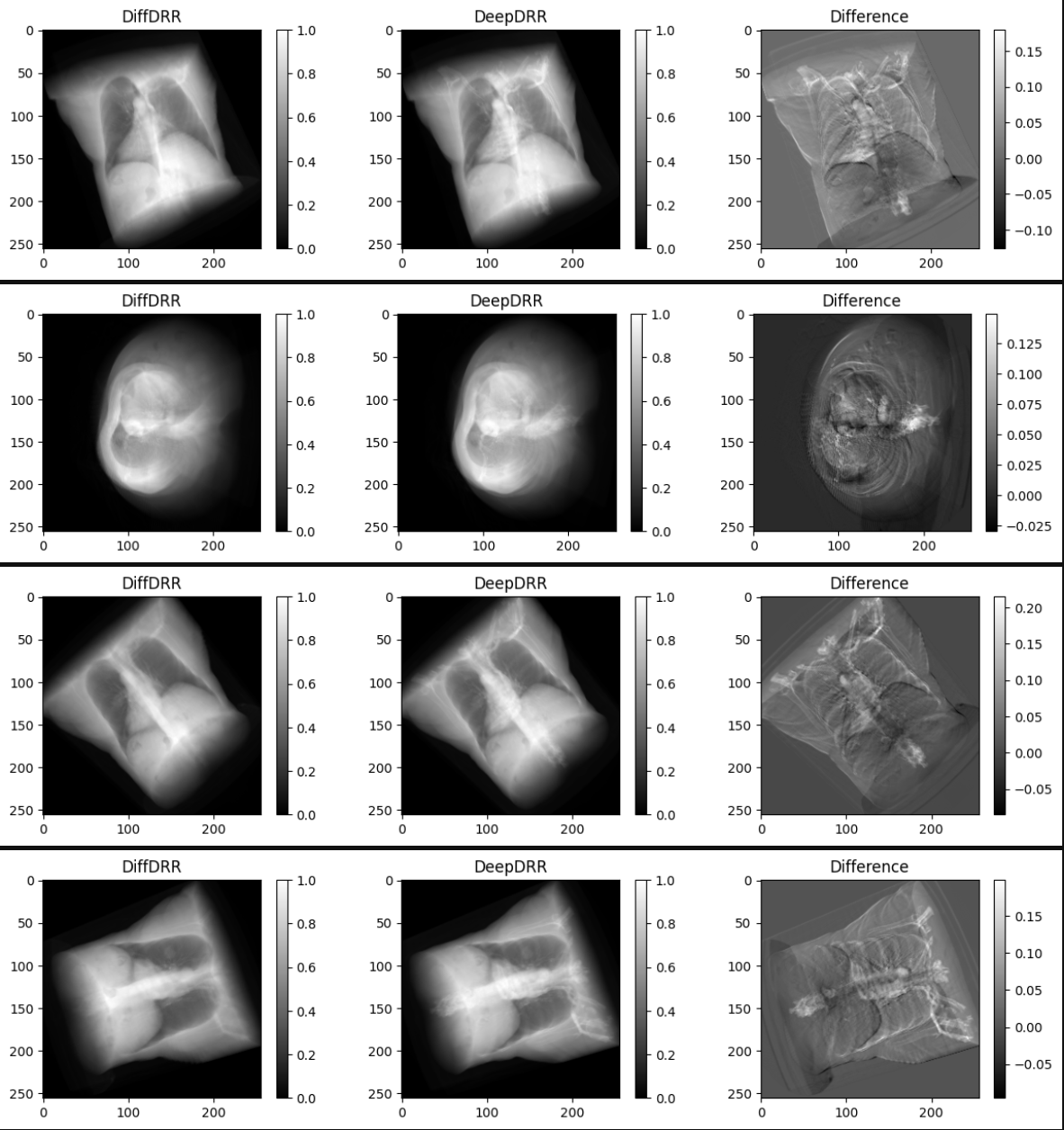 Change C-arm to move source and detector simultaneously · Issue #133 · eigenvivek/DiffDRR · GitHub