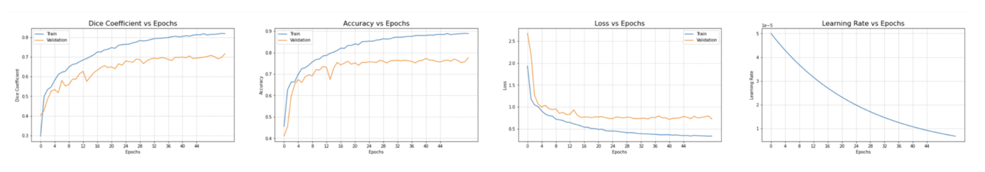 GitHub - Jupiter345/DSBA_DL_Project: Semantic Image Segmentation of arial imagery