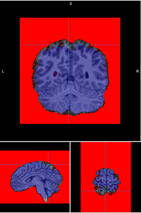 A new brain mask is still estimated while feeding skull-stripped T1w ...