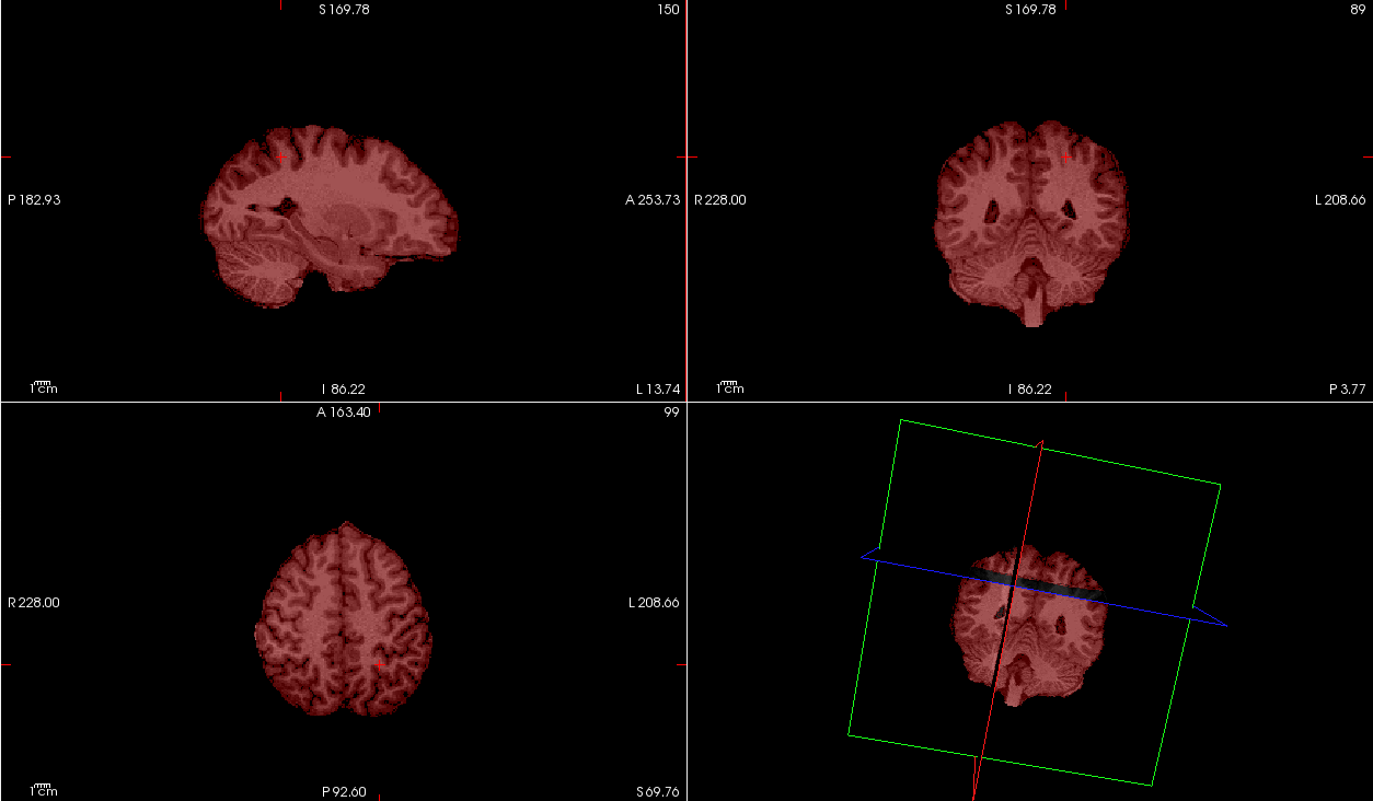 A new brain mask is still estimated while feeding skull-stripped T1w ...