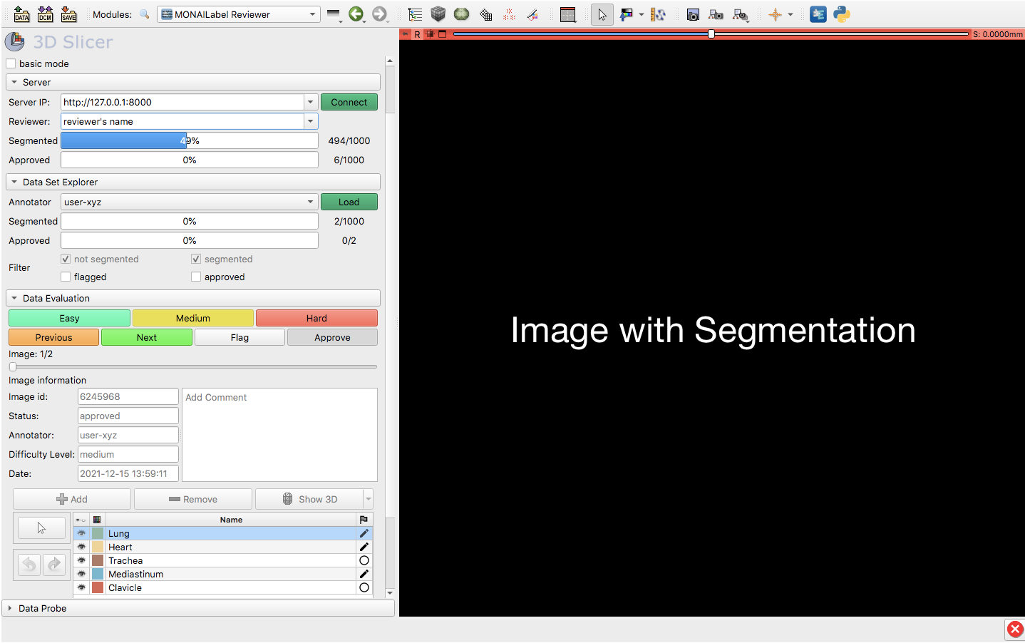Feature Proposal Monailabelreviewer · Issue 722 · Project Monai Monailabel · Github