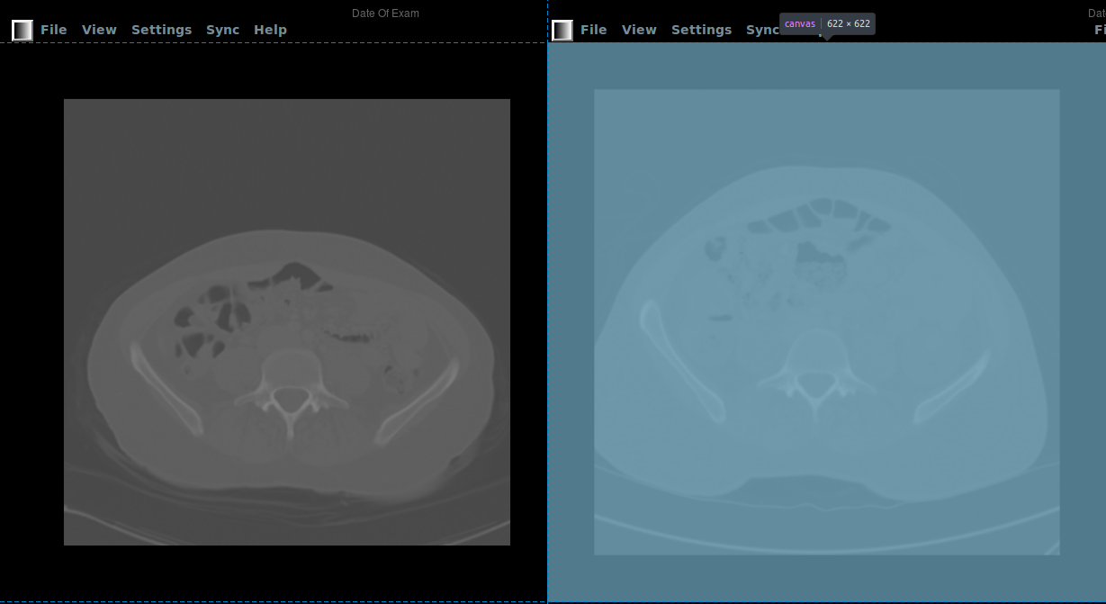 Cropped Volume in Canvas · Issue #132 · rii-mango/Papaya · GitHub