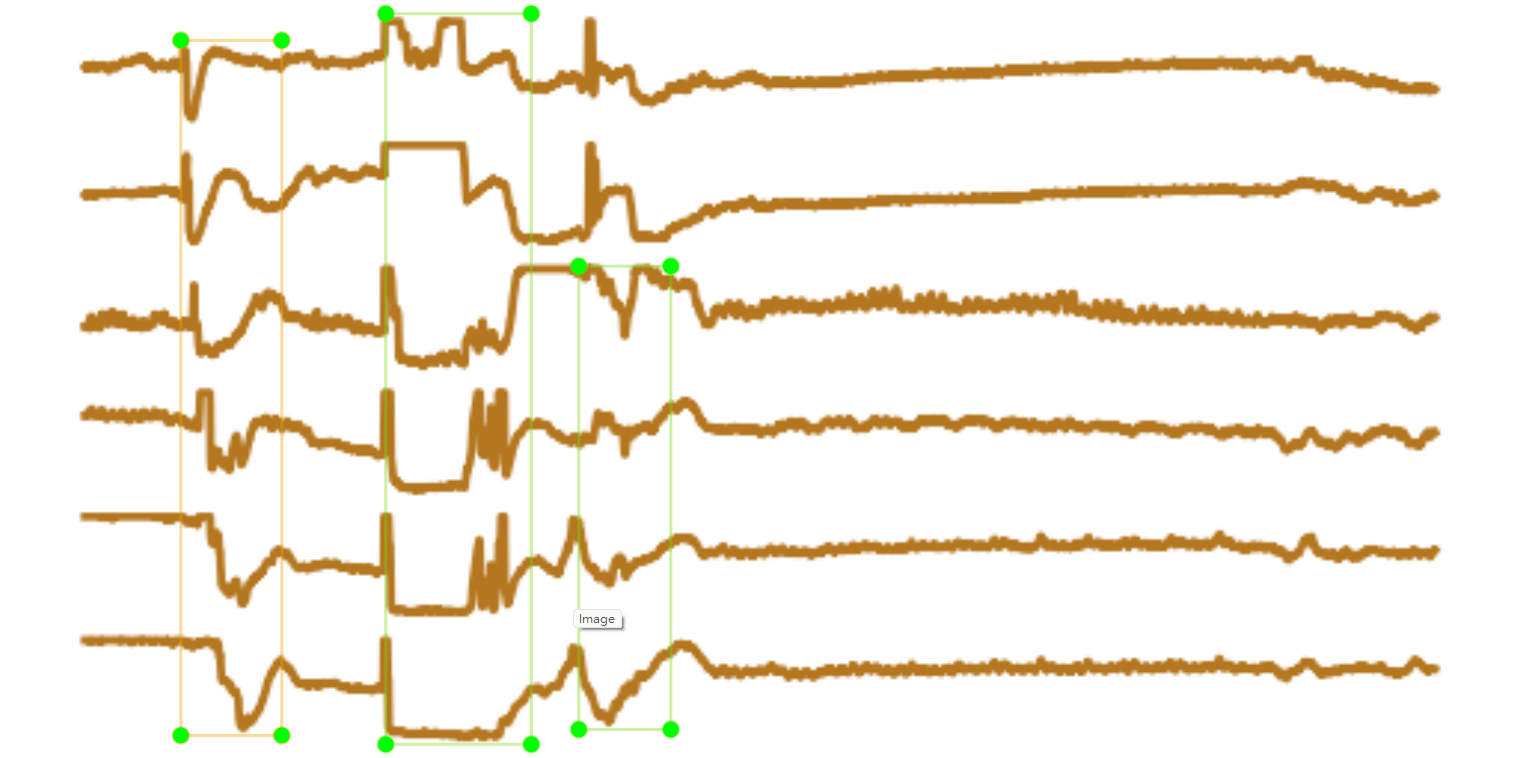 Questions about training self-generated signal images. · ultralytics ...