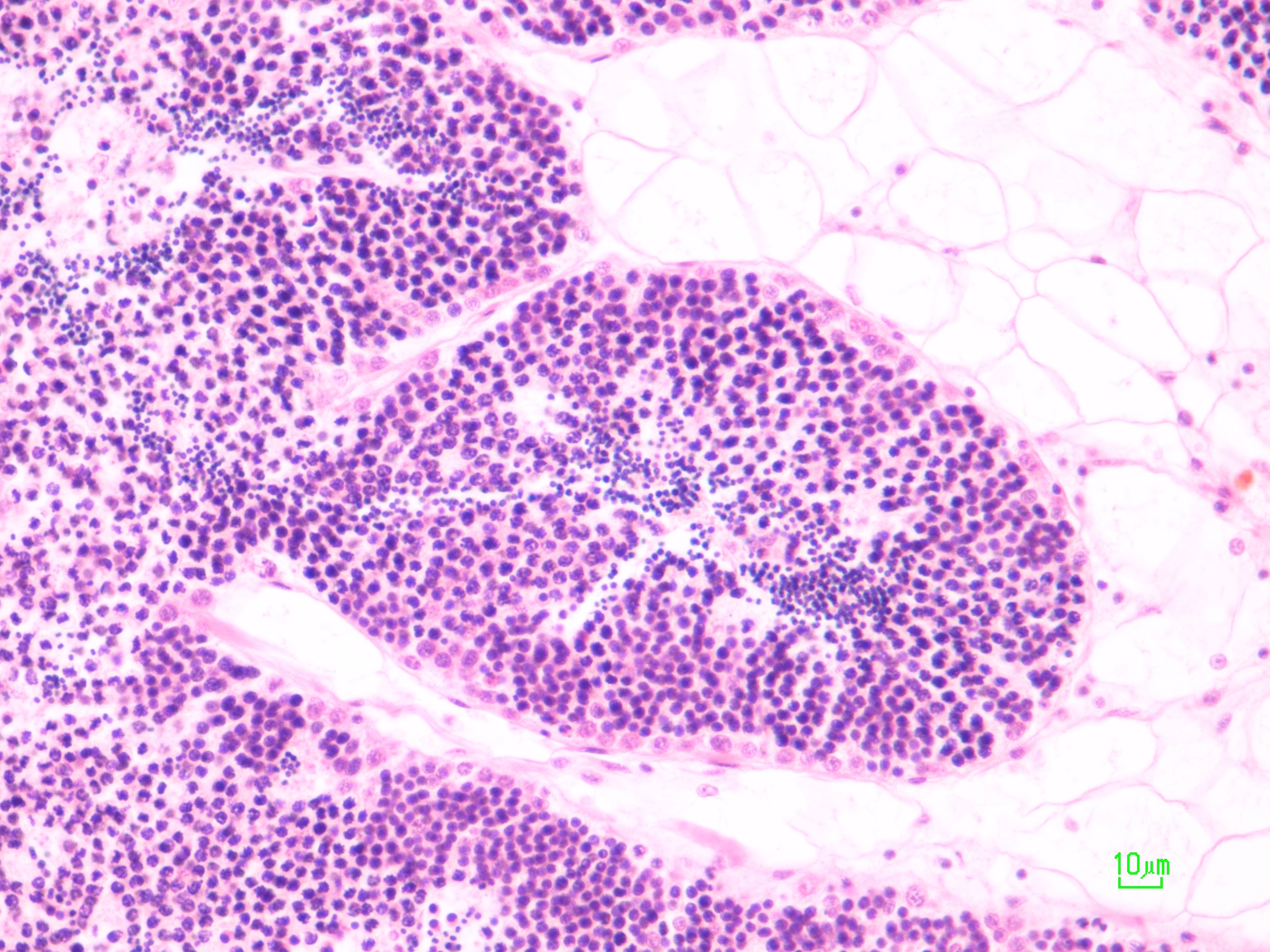 Density Counting Enhancement · Issue #1560 · ilastik/ilastik · GitHub