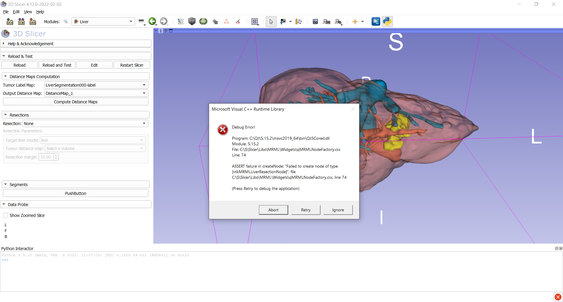 Failed to create node of type vtkMRMLLiverResectionNode · Issue #98 · ALive-research/Slicer ...