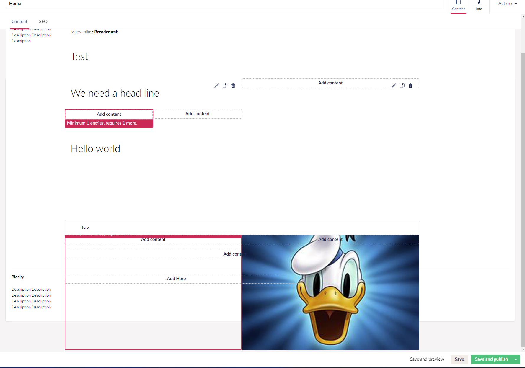 10 3rc Overlapping Ui In Block Grid Editor · Issue 13173 · Umbraco Umbraco Cms · Github