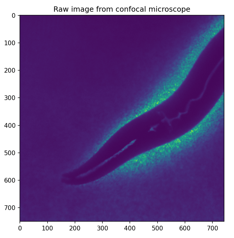 GitHub - biosharp18/Worm-Kymograph