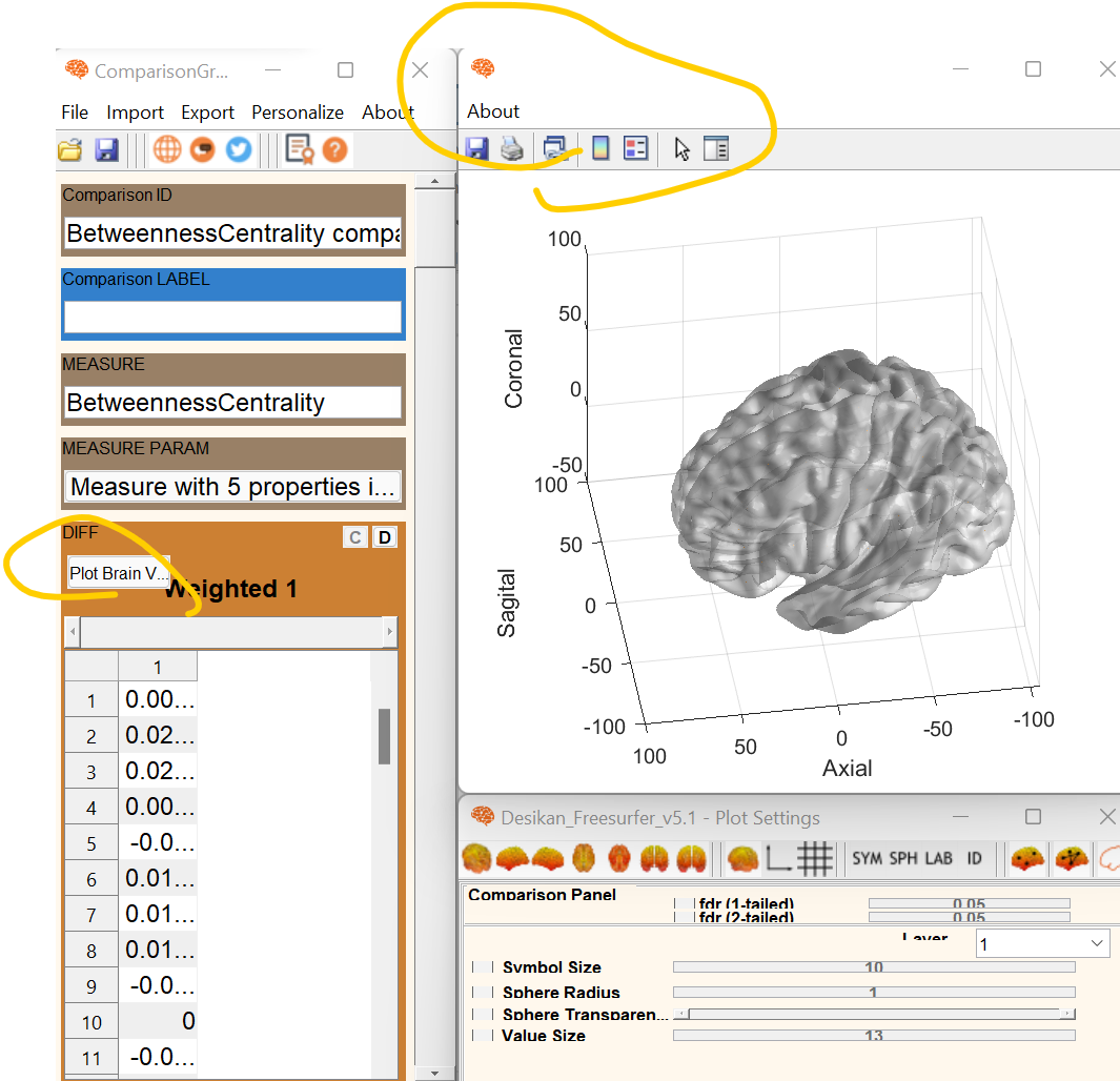 Final review for ST pipelines from KI · Issue #1205 · braph-software/BRAPH-2 · GitHub