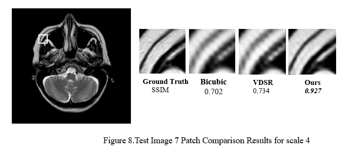 GitHub - fawazsammani/Deep-Convolutional-Networks-for-Magnification-of ...