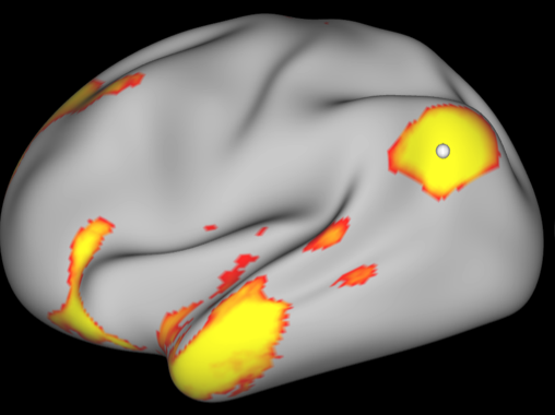 Dense connectome support on surface · Issue #301 · niivue/niivue · GitHub