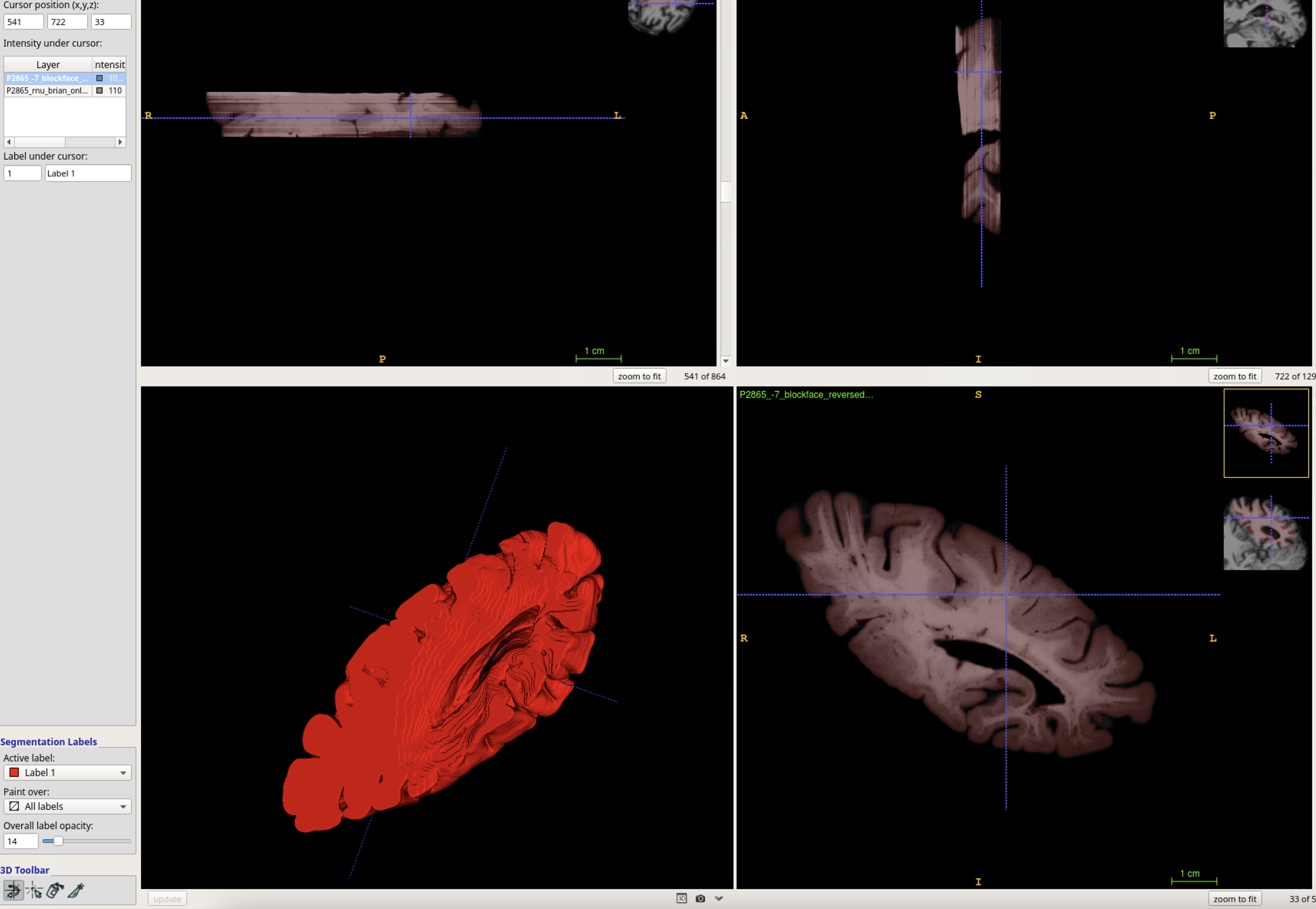 Improve result of using ANTs to map/register high resolution 3d brain photos stack to MRI ...