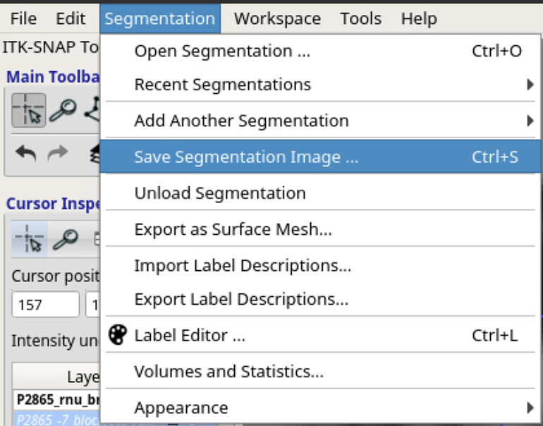 Improve result of using ANTs to map/register high resolution 3d brain photos stack to MRI ...