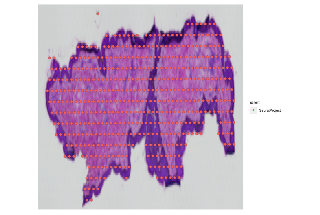 Spatialplot Enlarged Tissue Image Relative To Spot Size · Issue 4930 · Satijalabseurat · Github