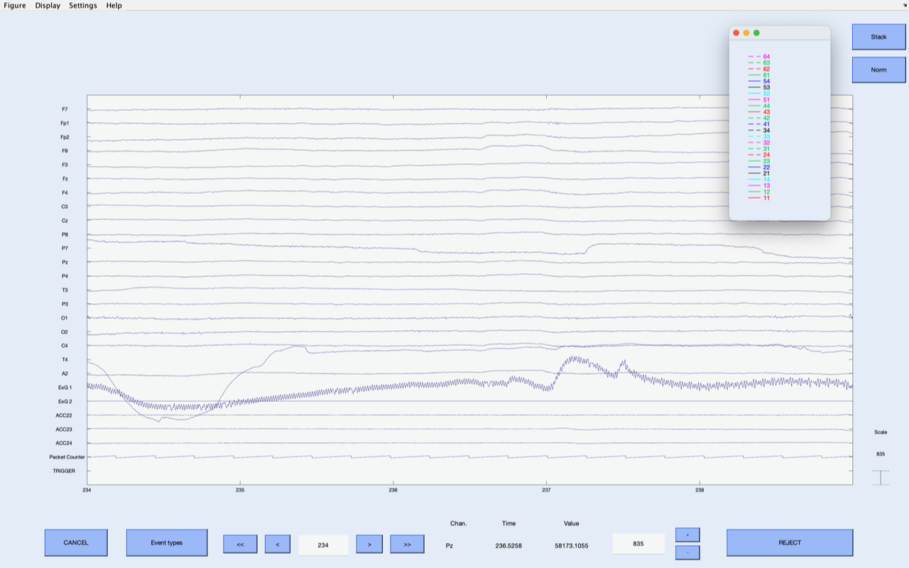 Event Types Not Appearing When Plotting Raw Data · Issue 600 · Sccn Eeglab · Github