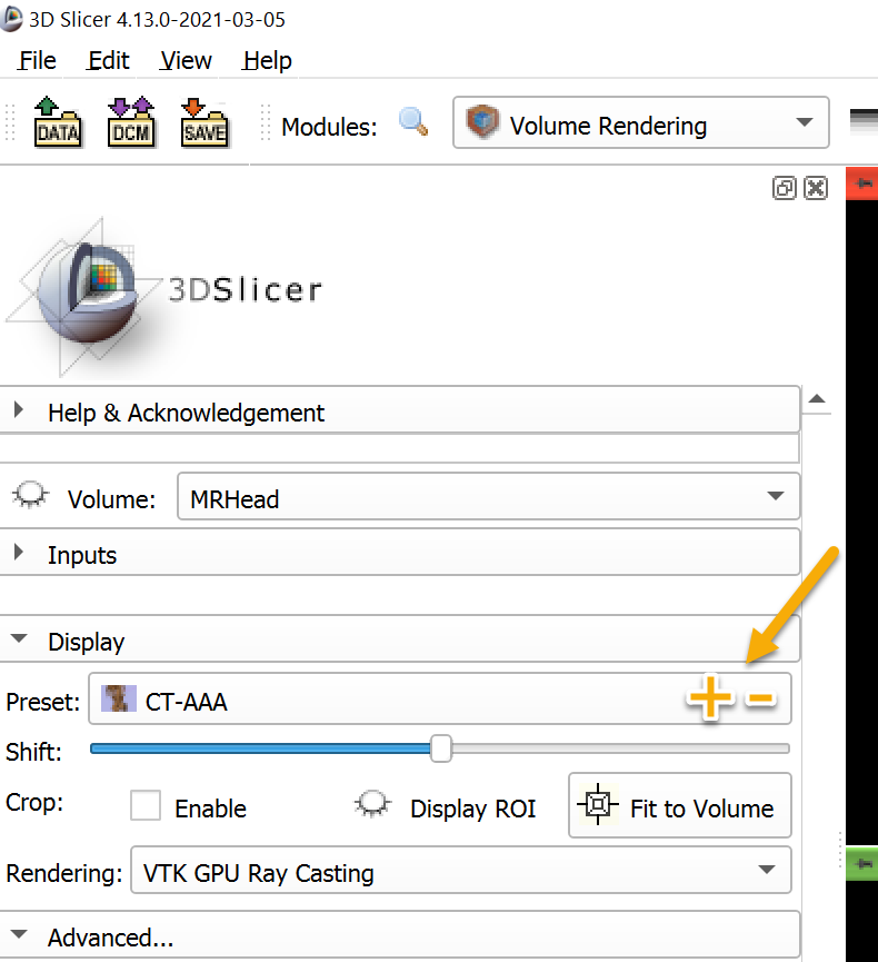 Save current volume rendering setting as a preset · Issue #5505 · Slicer/Slicer · GitHub