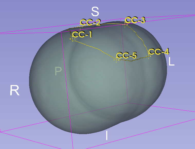 Surface-constrained markups curve is transformed incorrectly · Issue #5661 · Slicer/Slicer · GitHub