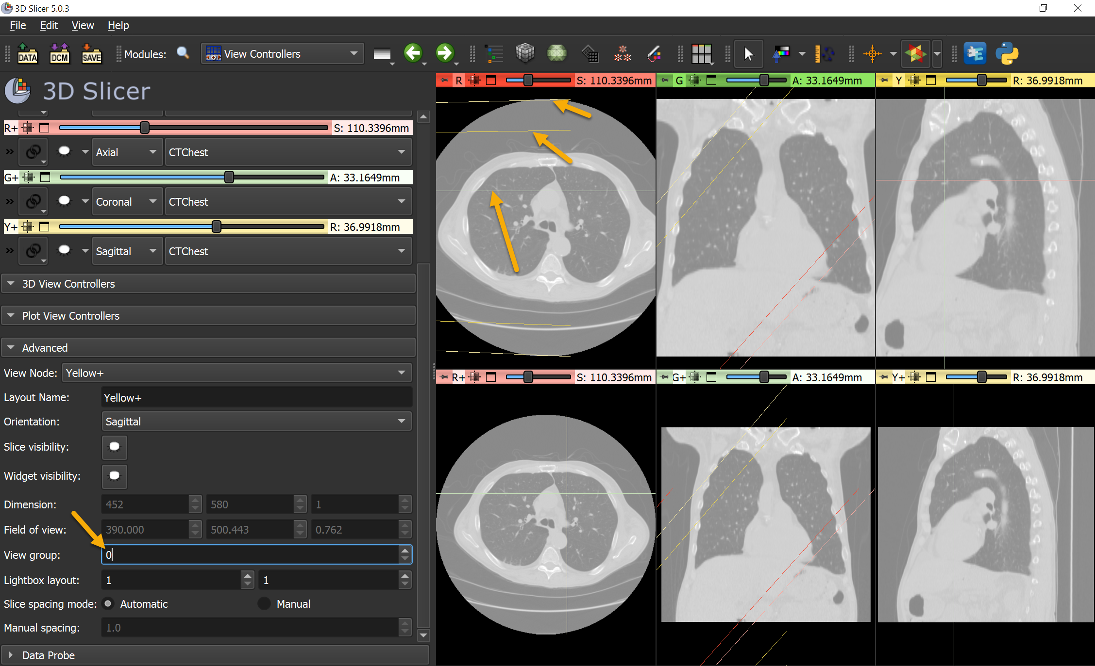 Interactive Slice Intersection Displays Random Lines If More Than 3 Views · Issue 6487 · Slicer