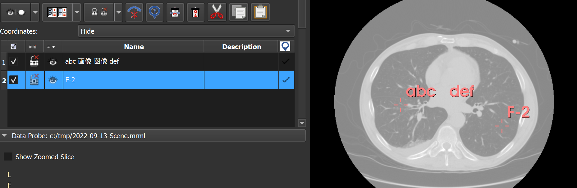 Display Unicode Characters In Markups In Slice And 3d Views · Issue 6530 · Slicerslicer · Github