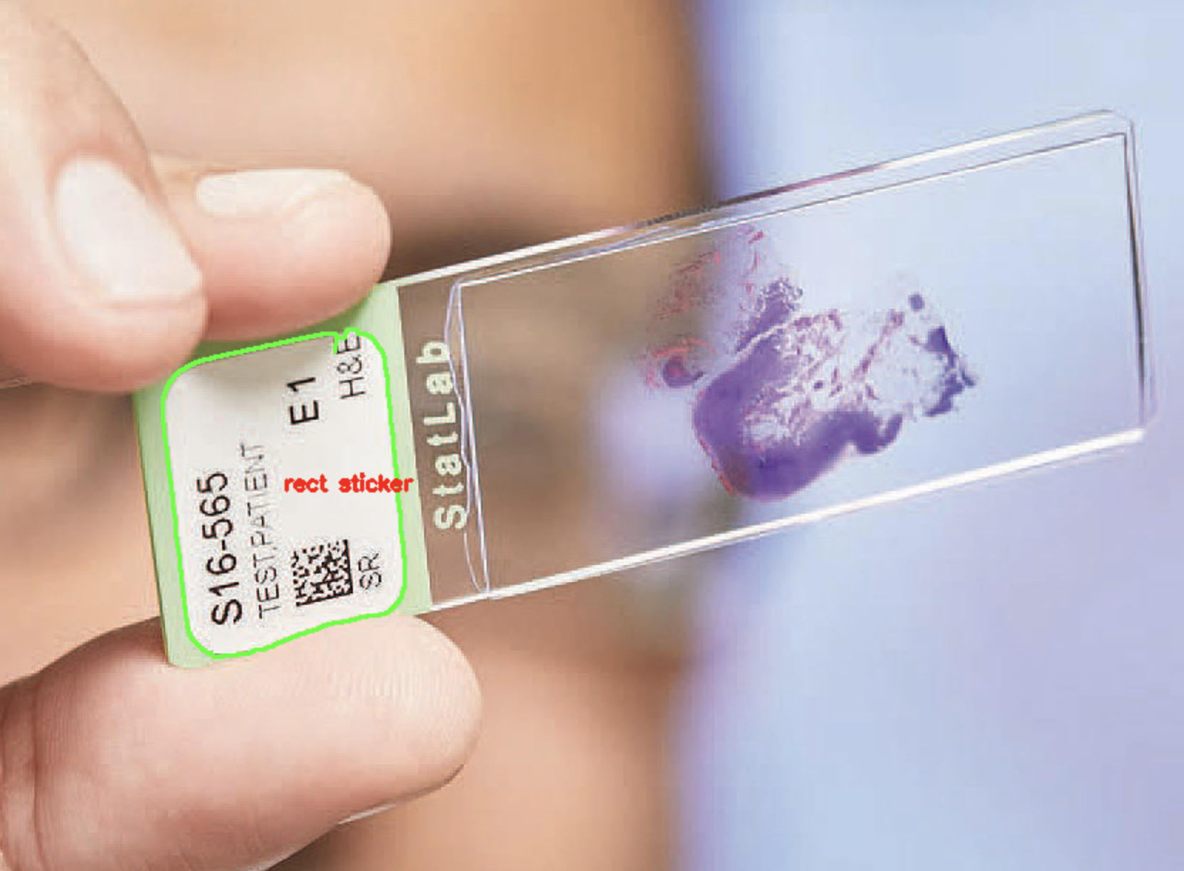 GitHub - sohankancherla/sticker-detection: Identify stickers with text ...